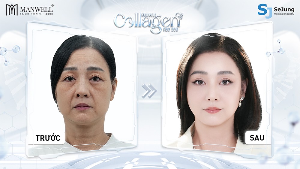 Hành trình tìm lại Hào Quang Nữ Chính sau hơn 3 thập kỷ của NSƯT Mỹ Duyên